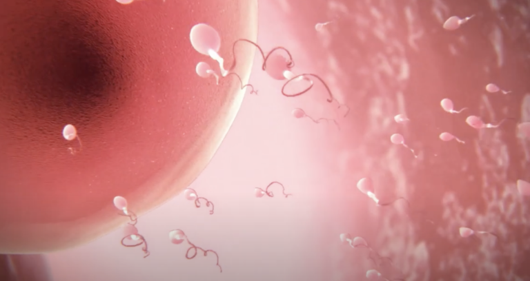 Femasys Completes the First In-Office Commercial Procedure with the FDA ...