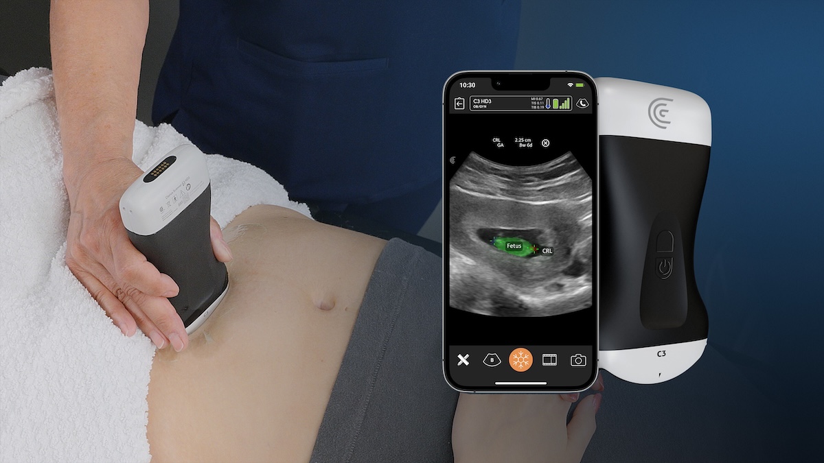 FDA Clears Clarius OB AI, a Handheld Ultrasound Fetal Biometric ...